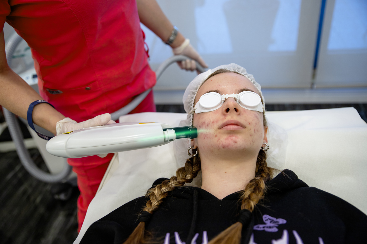 Treating Acne in Japan: A Savvy Guide - Savvy Tokyo